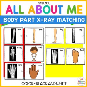 Body Part X-Ray Matching